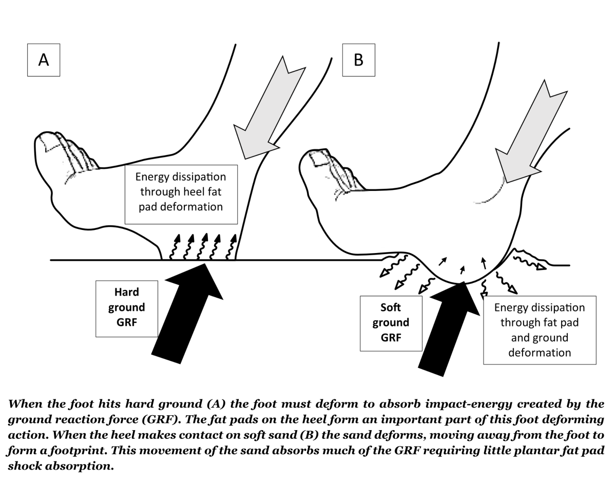 Fat Pad Atrophy Insoles And Orthotics Healthy Step