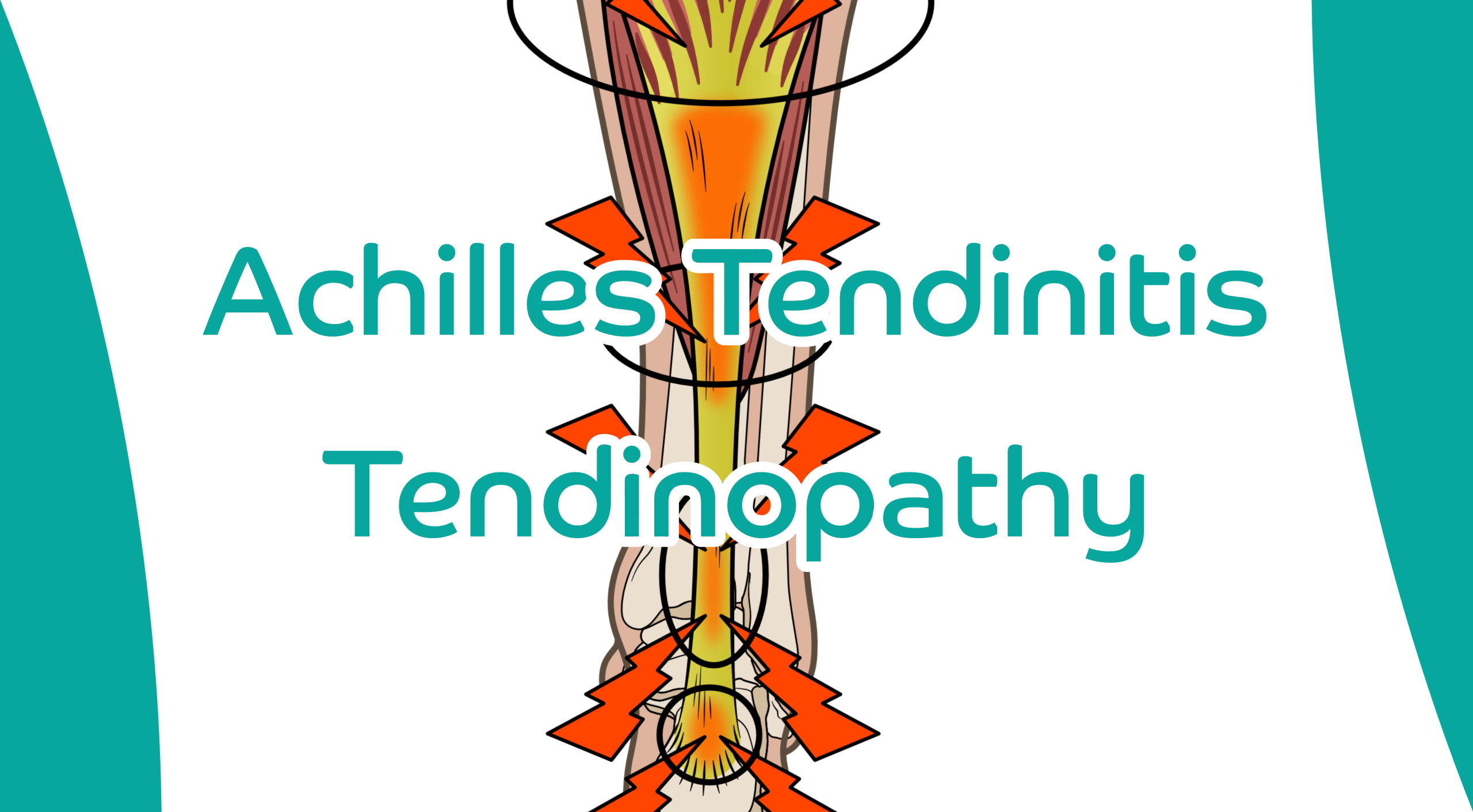 Achilles Tendinitis/Tendinopathy: The pain behind the ankle/heel ...